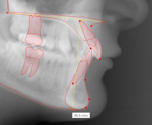 Analyses – facad.com